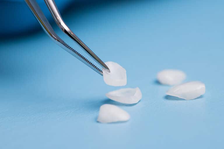 What Porcelain Veneers Can Do for Your Smile | Carmel, IN